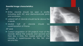 RADIOGRAPHIC TECHNIQUE OF SHOULDER(1).pptx