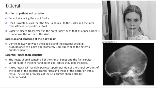 Radiographic technique of skull | PPTX