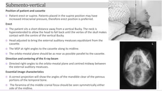 Radiographic technique of skull | PPTX