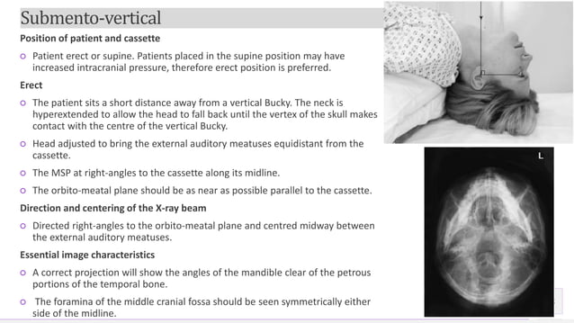Radiographic technique of skull | PPTX