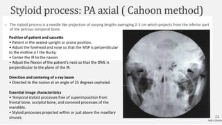 Radiographic technique of skull | PPTX