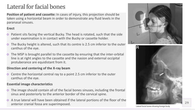 Radiographic technique of skull | PPTX