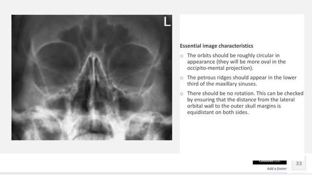 Radiographic technique of skull | PPTX