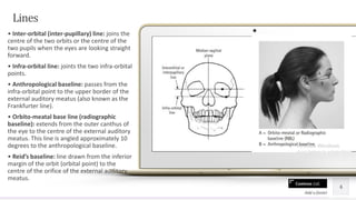 Radiographic technique of skull | PPTX