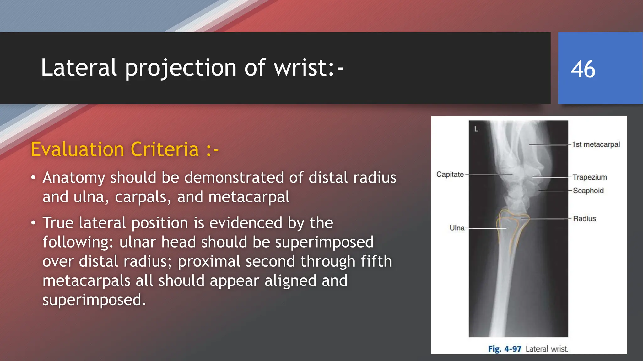 radiographictechniqueofupperlimbbysagarchaulagainautosaved-240228170831 ...