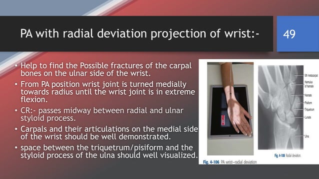 radiographictechniqueofupperlimbbysagarchaulagainautosaved-240228170831 ...