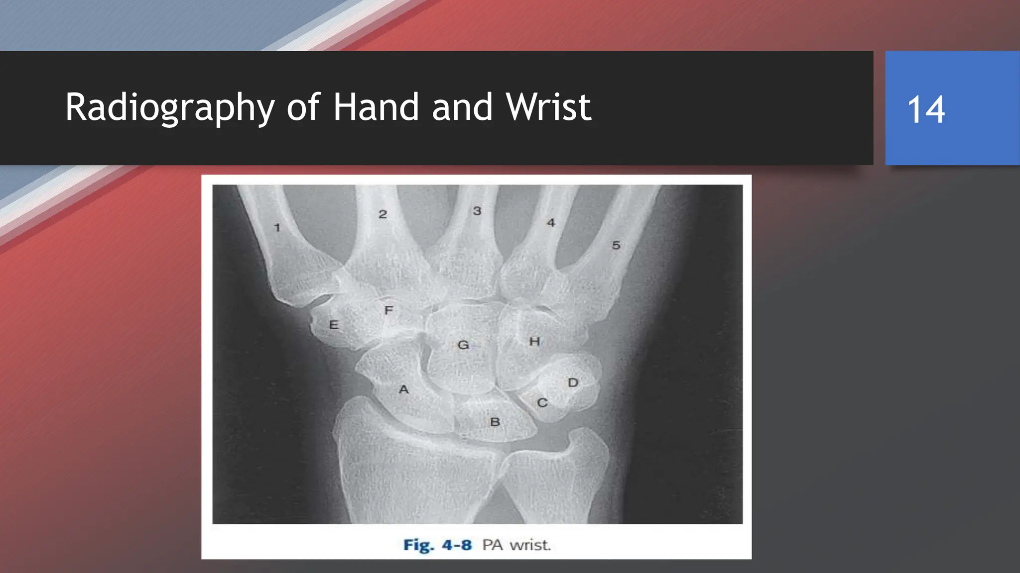 RADIOGRAPHIC TECHNIQUE OF UPPER LIMB BY SAGAR CHAULAGAIN | PPTX
