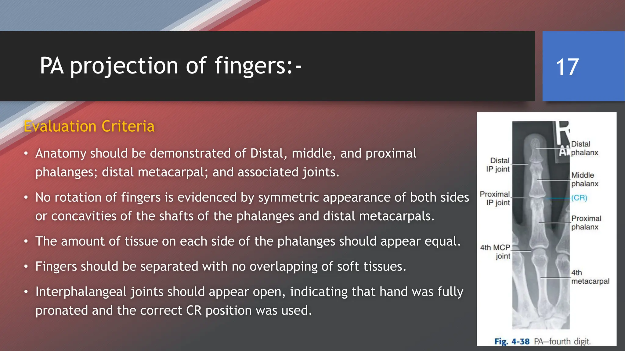 RADIOGRAPHIC TECHNIQUE OF UPPER LIMB BY SAGAR CHAULAGAIN | PPTX