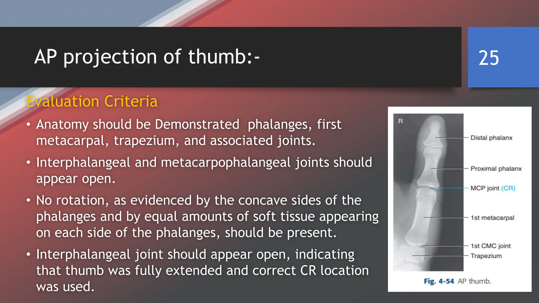 RADIOGRAPHIC TECHNIQUE OF UPPER LIMB BY SAGAR CHAULAGAIN | PPTX