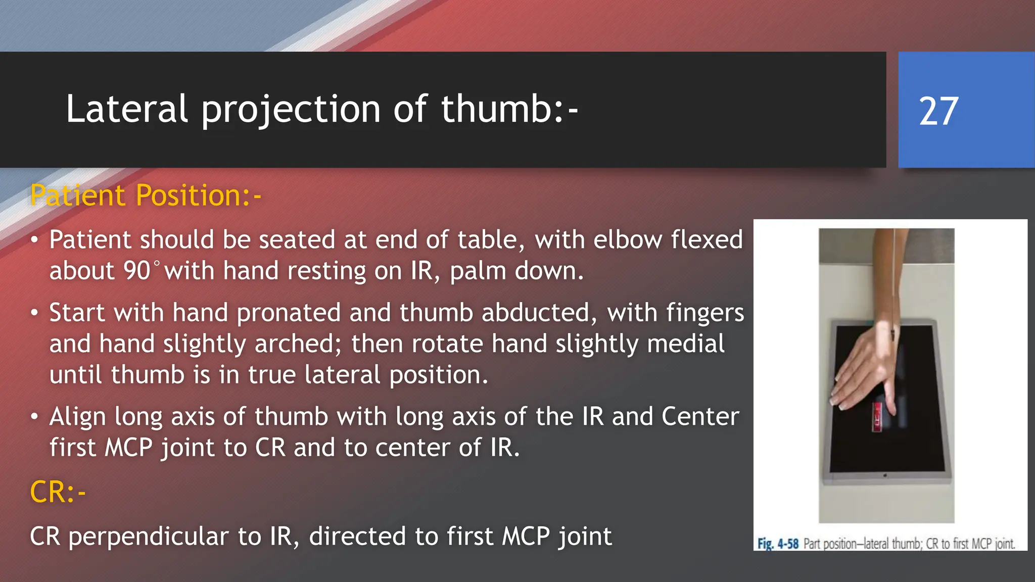 RADIOGRAPHIC TECHNIQUE OF UPPER LIMB BY SAGAR CHAULAGAIN | PPTX
