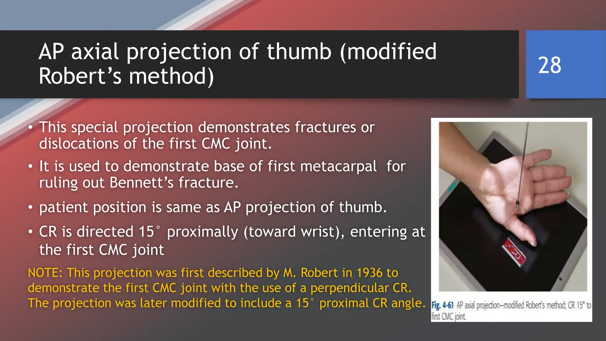 RADIOGRAPHIC TECHNIQUE OF UPPER LIMB BY SAGAR CHAULAGAIN | PPTX