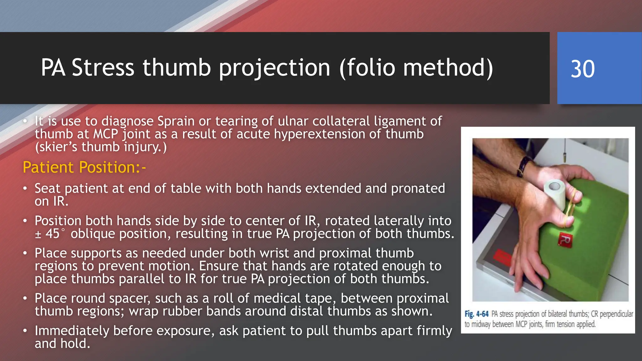RADIOGRAPHIC TECHNIQUE OF UPPER LIMB BY SAGAR CHAULAGAIN | PPTX
