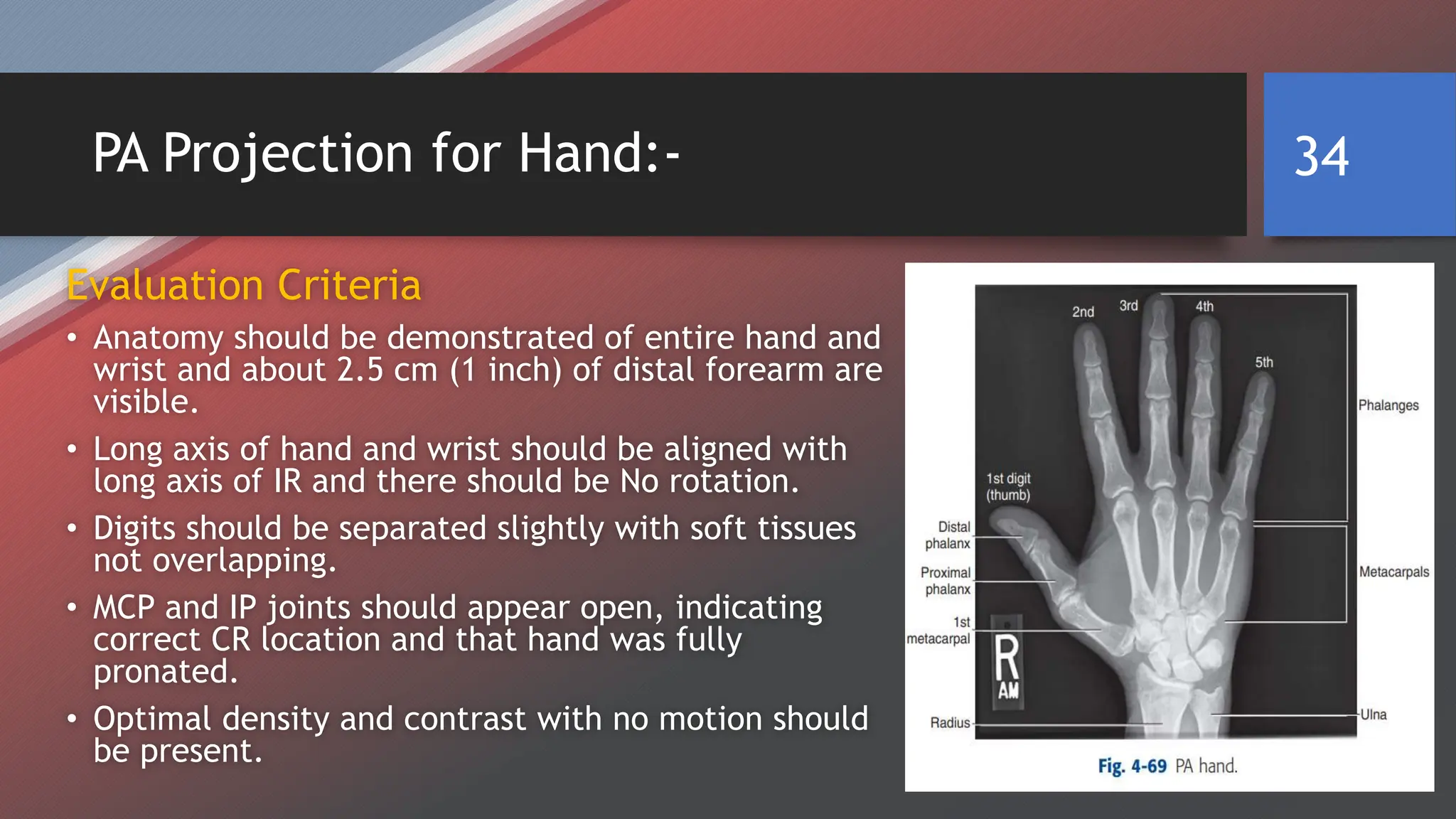 RADIOGRAPHIC TECHNIQUE OF UPPER LIMB BY SAGAR CHAULAGAIN | PPTX