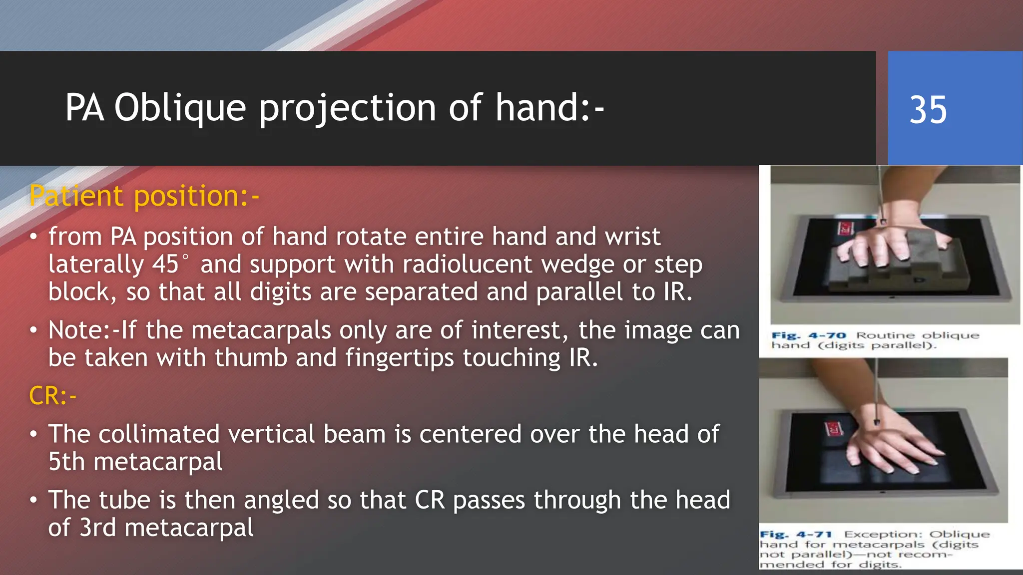 RADIOGRAPHIC TECHNIQUE OF UPPER LIMB BY SAGAR CHAULAGAIN | PPTX