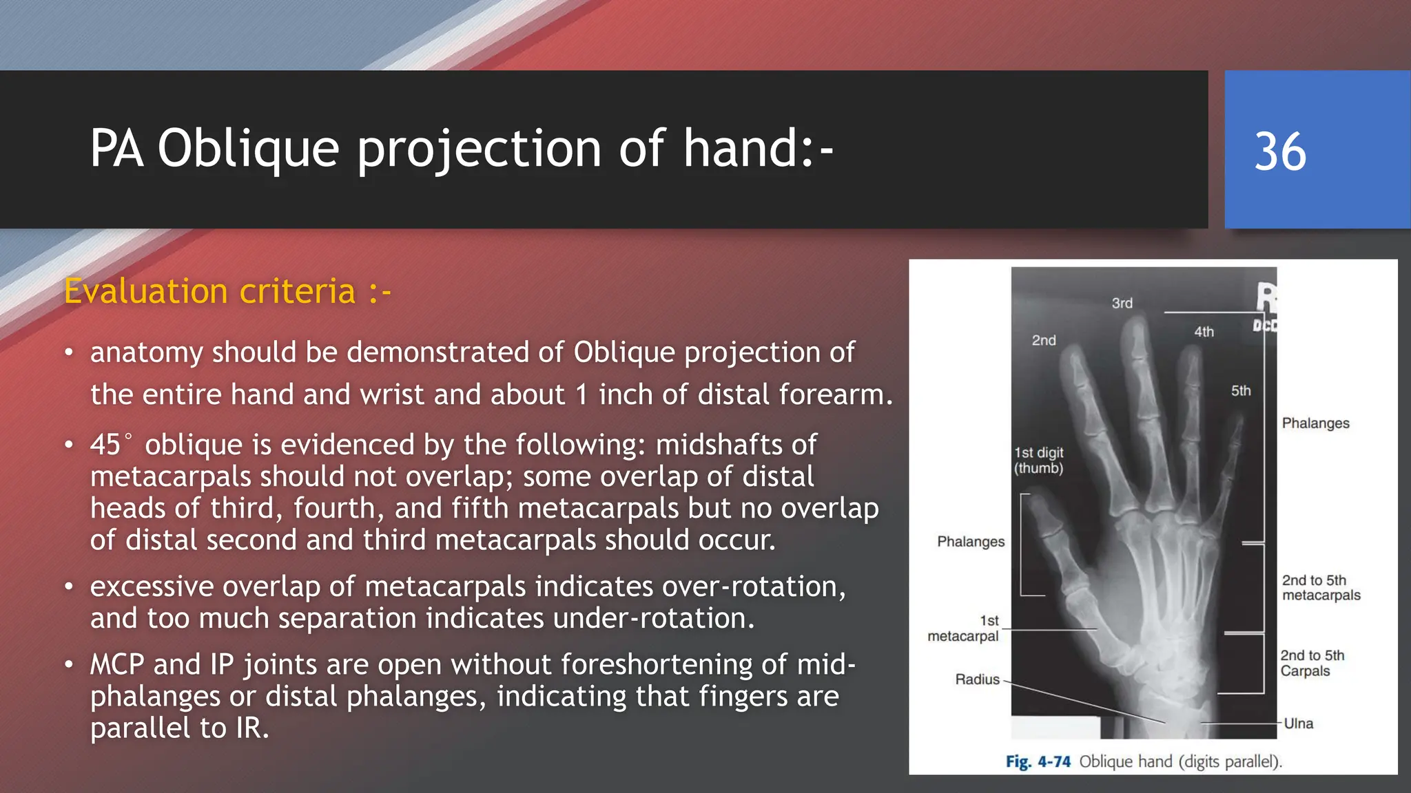RADIOGRAPHIC TECHNIQUE OF UPPER LIMB BY SAGAR CHAULAGAIN | PPTX