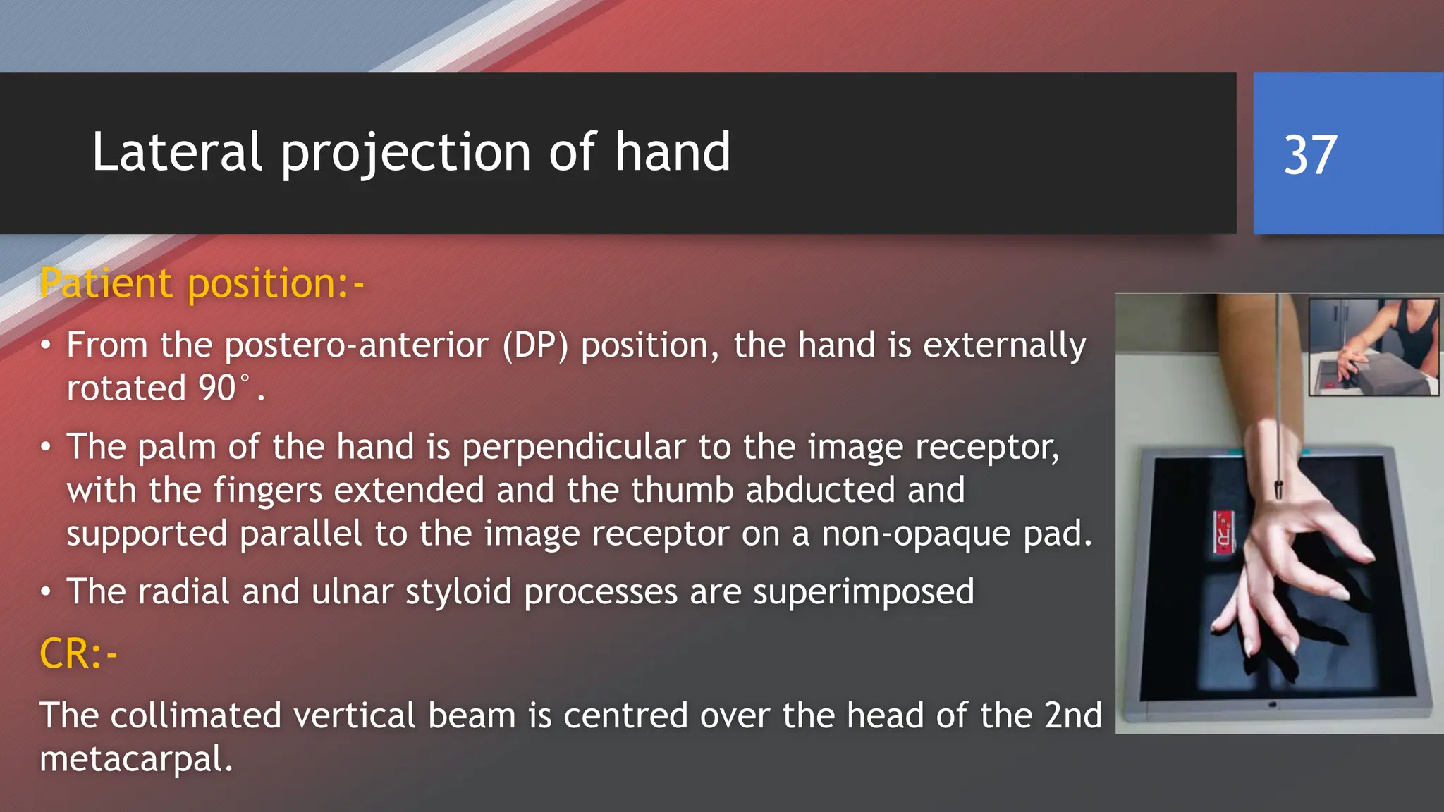 RADIOGRAPHIC TECHNIQUE OF UPPER LIMB BY SAGAR CHAULAGAIN | PPTX