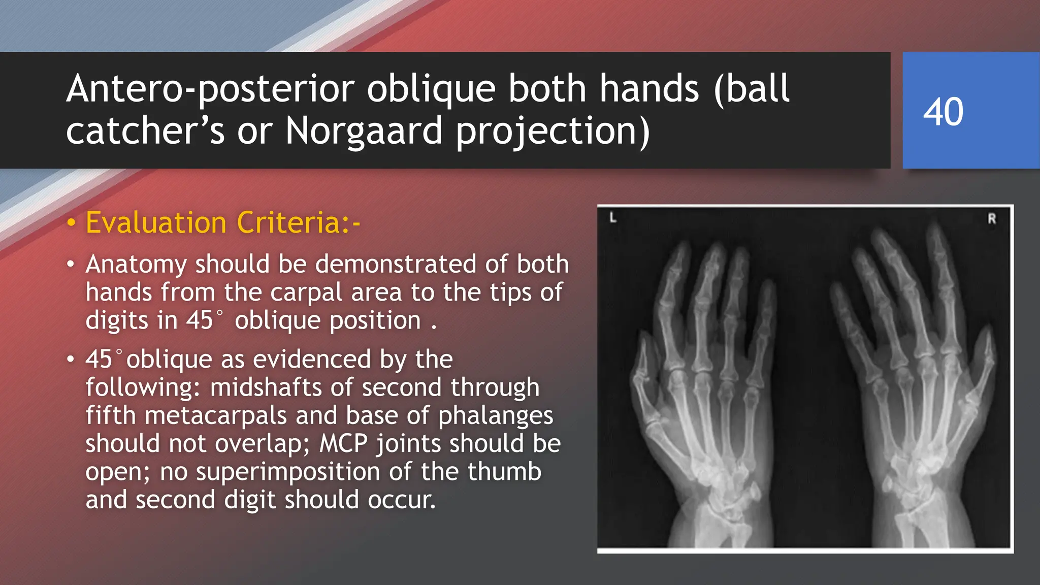 RADIOGRAPHIC TECHNIQUE OF UPPER LIMB BY SAGAR CHAULAGAIN | PPTX
