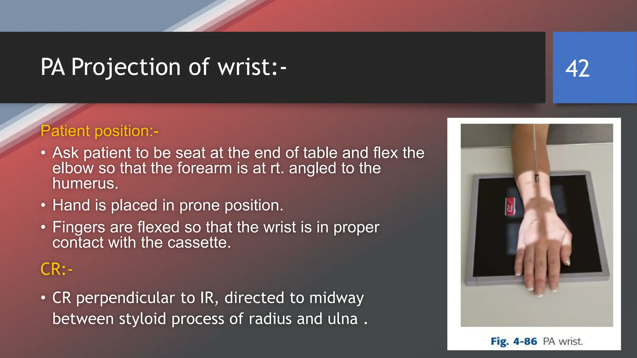 RADIOGRAPHIC TECHNIQUE OF UPPER LIMB BY SAGAR CHAULAGAIN | PPTX