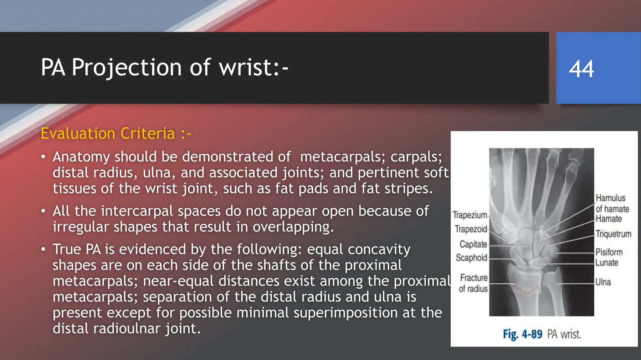 RADIOGRAPHIC TECHNIQUE OF UPPER LIMB BY SAGAR CHAULAGAIN | PPTX