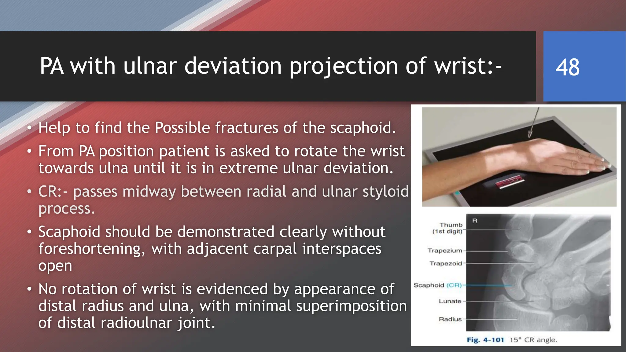 RADIOGRAPHIC TECHNIQUE OF UPPER LIMB BY SAGAR CHAULAGAIN | PPTX