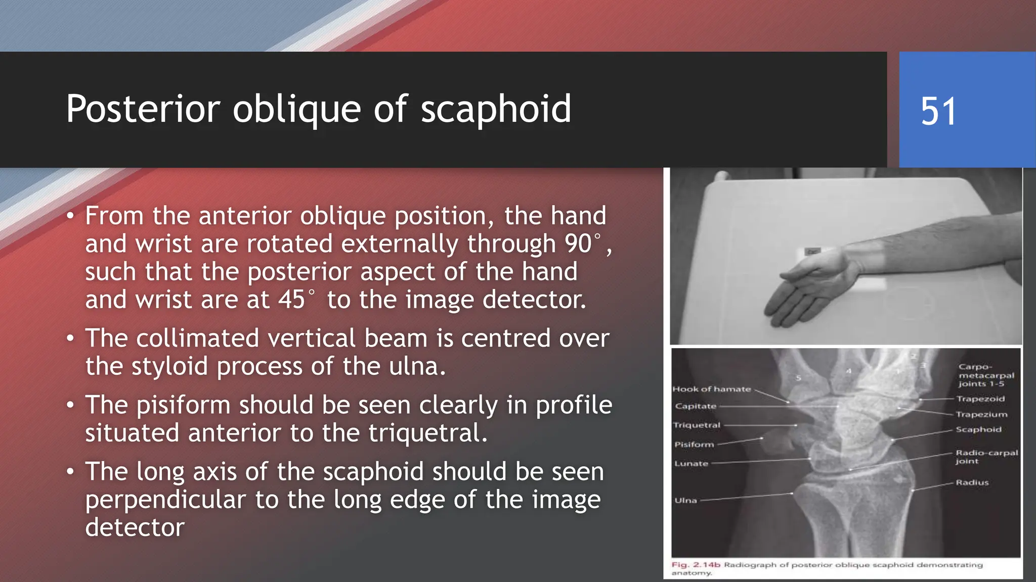 RADIOGRAPHIC TECHNIQUE OF UPPER LIMB BY SAGAR CHAULAGAIN | PPTX
