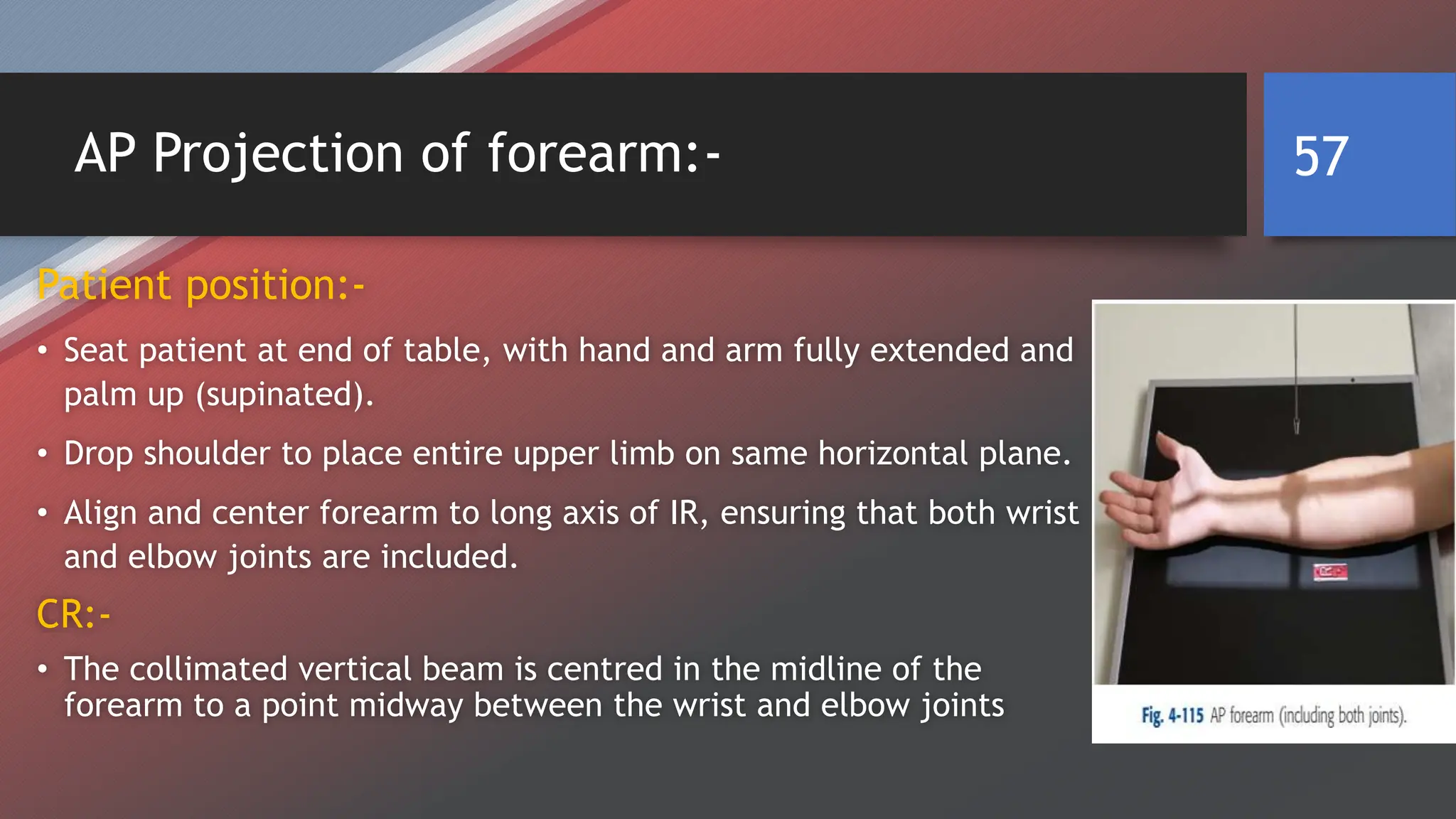 RADIOGRAPHIC TECHNIQUE OF UPPER LIMB BY SAGAR CHAULAGAIN | PPTX