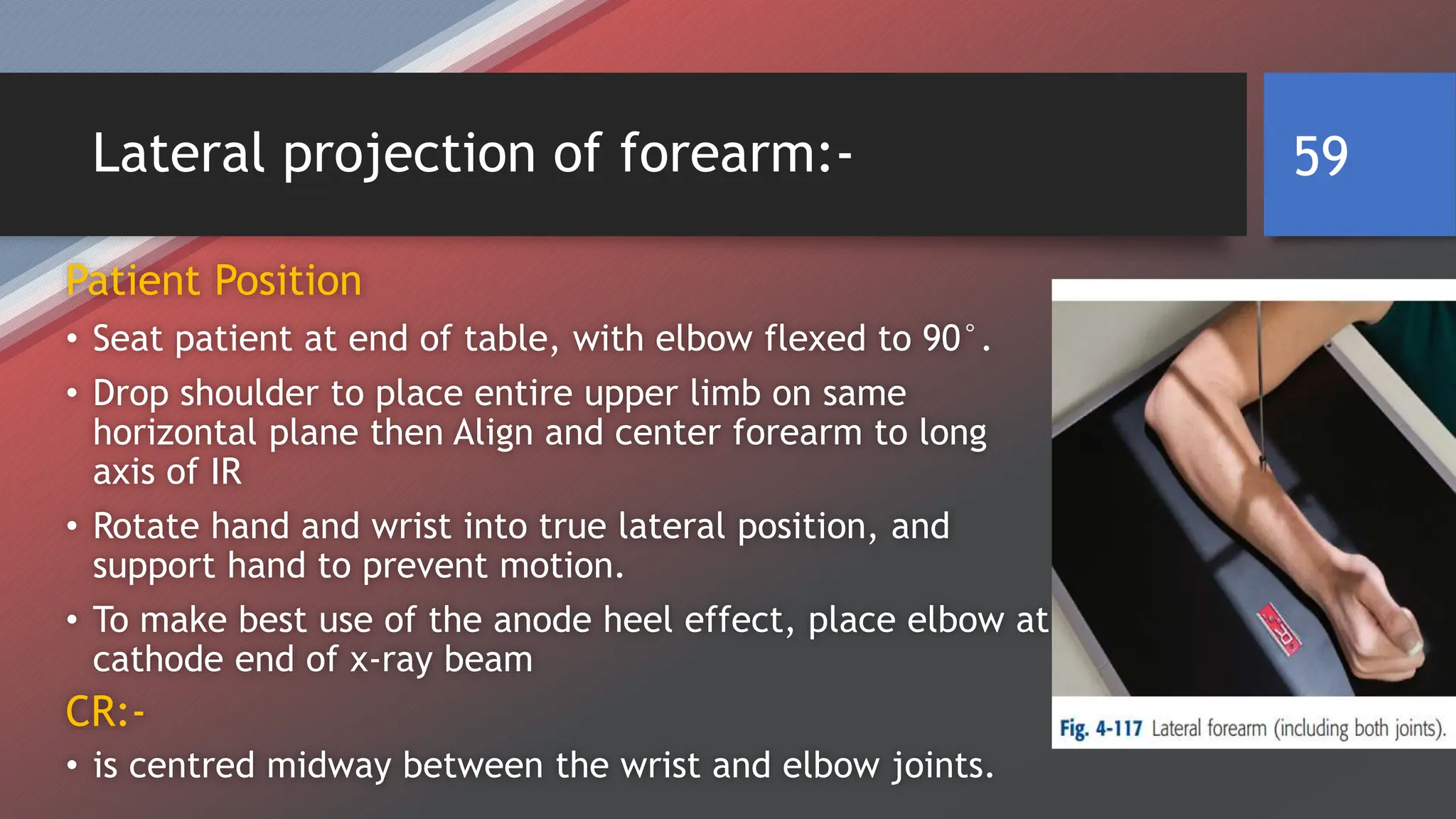 RADIOGRAPHIC TECHNIQUE OF UPPER LIMB BY SAGAR CHAULAGAIN | PPTX