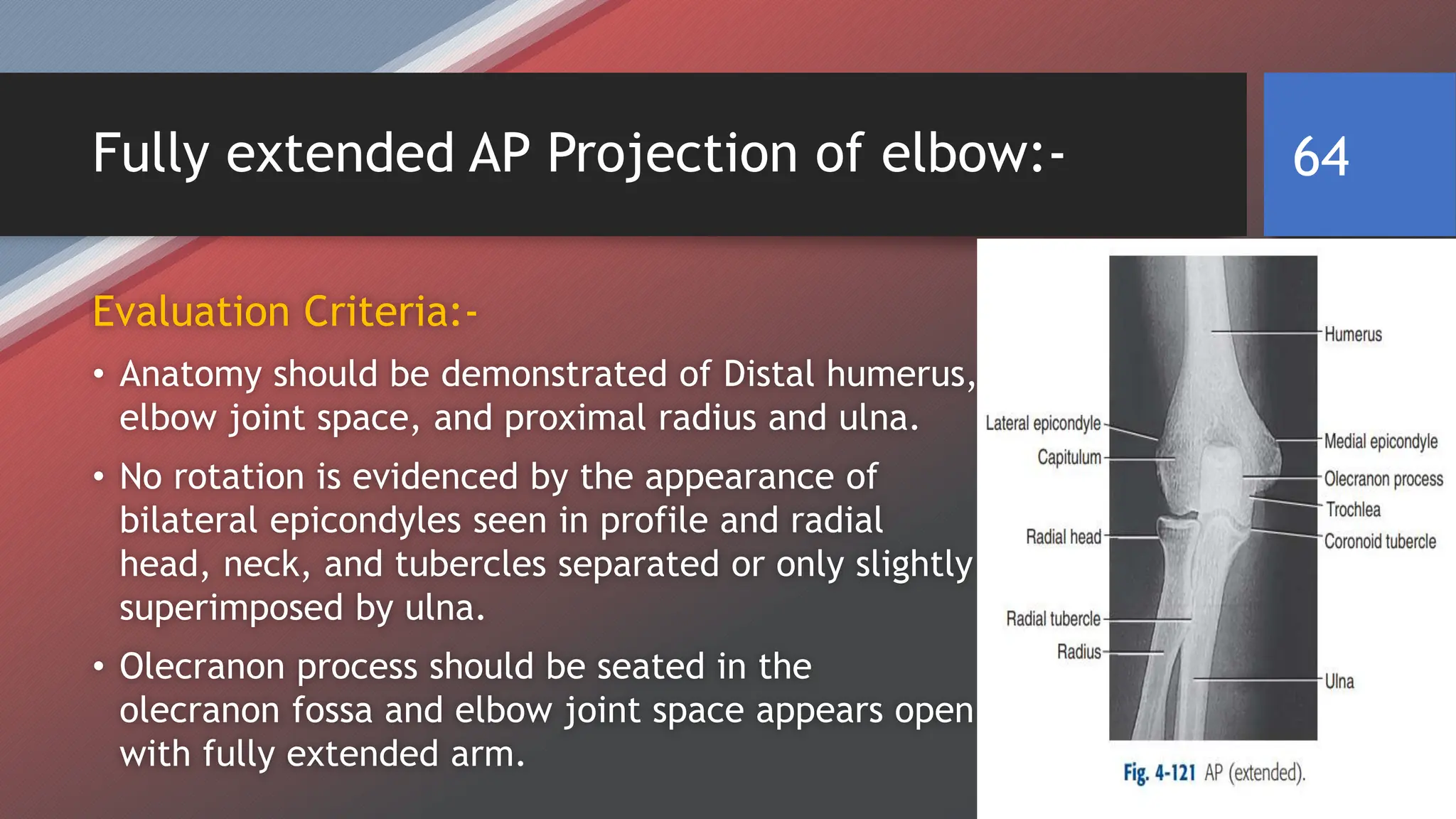 RADIOGRAPHIC TECHNIQUE OF UPPER LIMB BY SAGAR CHAULAGAIN | PPTX