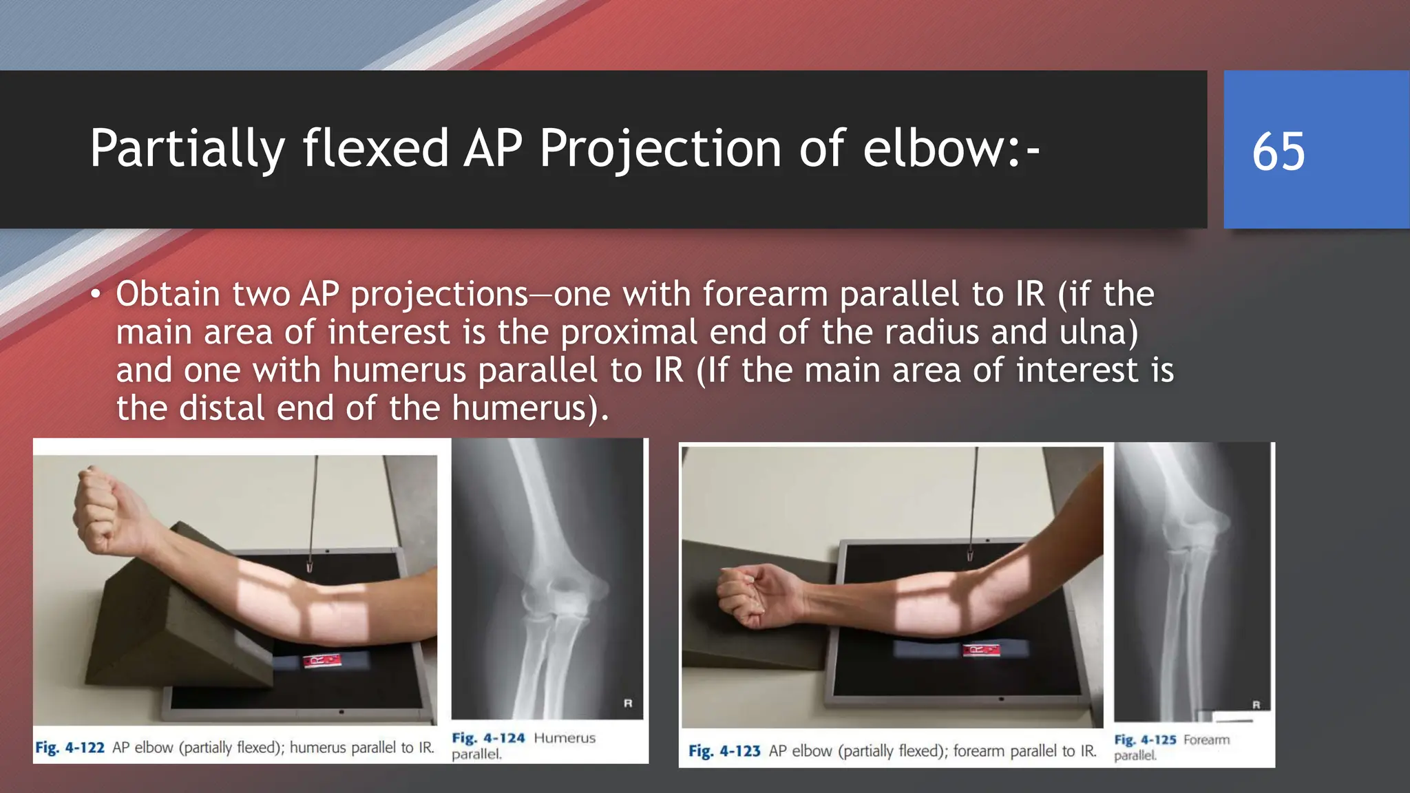 RADIOGRAPHIC TECHNIQUE OF UPPER LIMB BY SAGAR CHAULAGAIN | PPTX