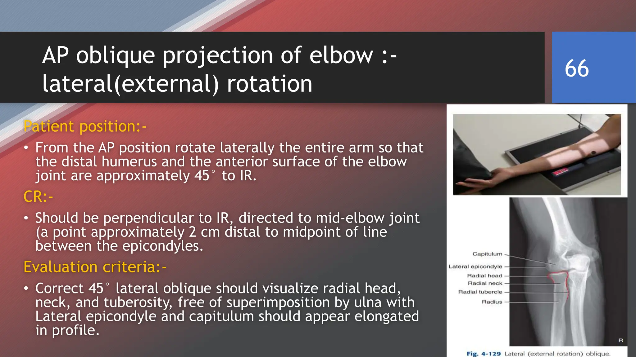 RADIOGRAPHIC TECHNIQUE OF UPPER LIMB BY SAGAR CHAULAGAIN | PPTX