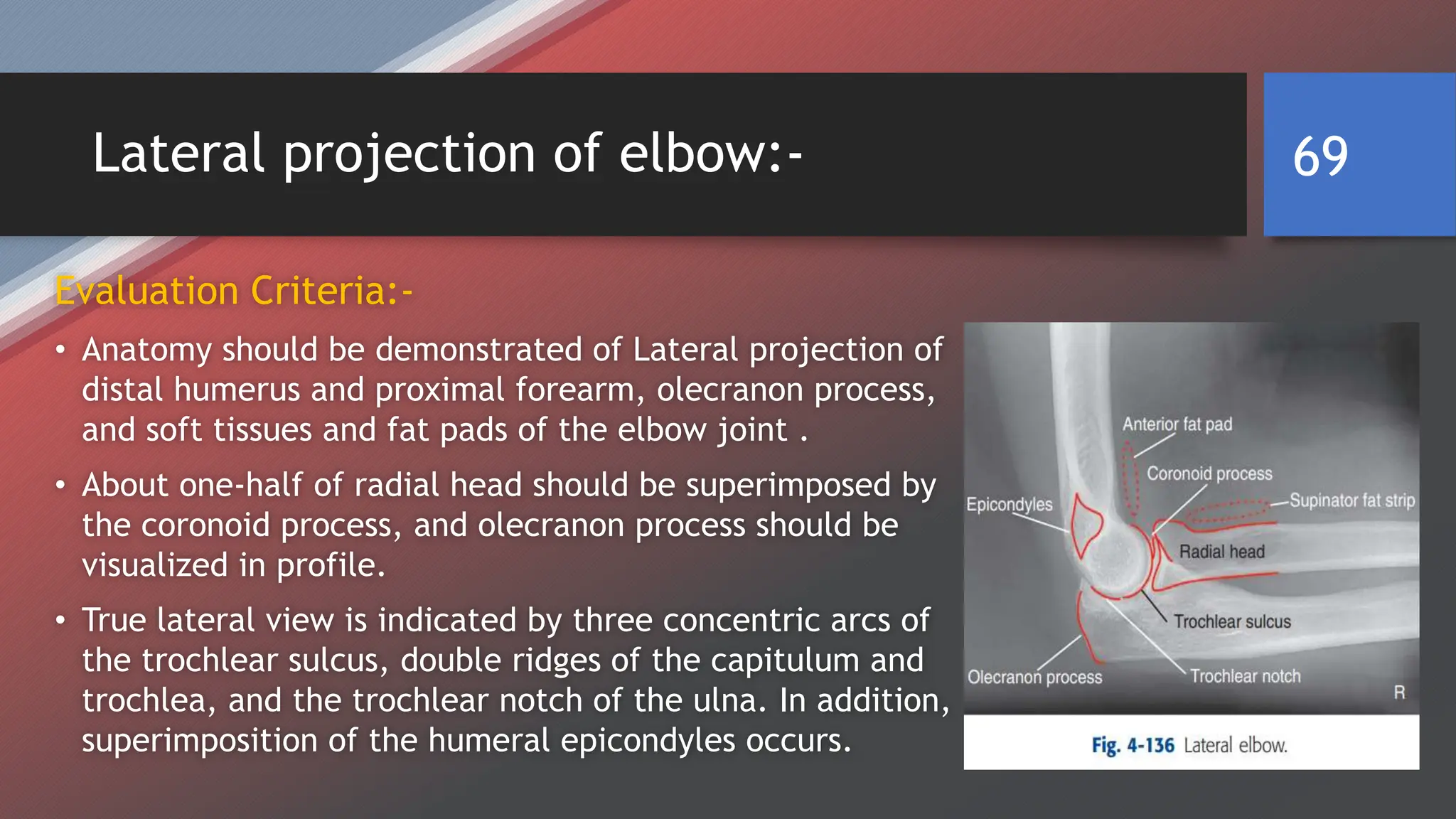 RADIOGRAPHIC TECHNIQUE OF UPPER LIMB BY SAGAR CHAULAGAIN | PPTX