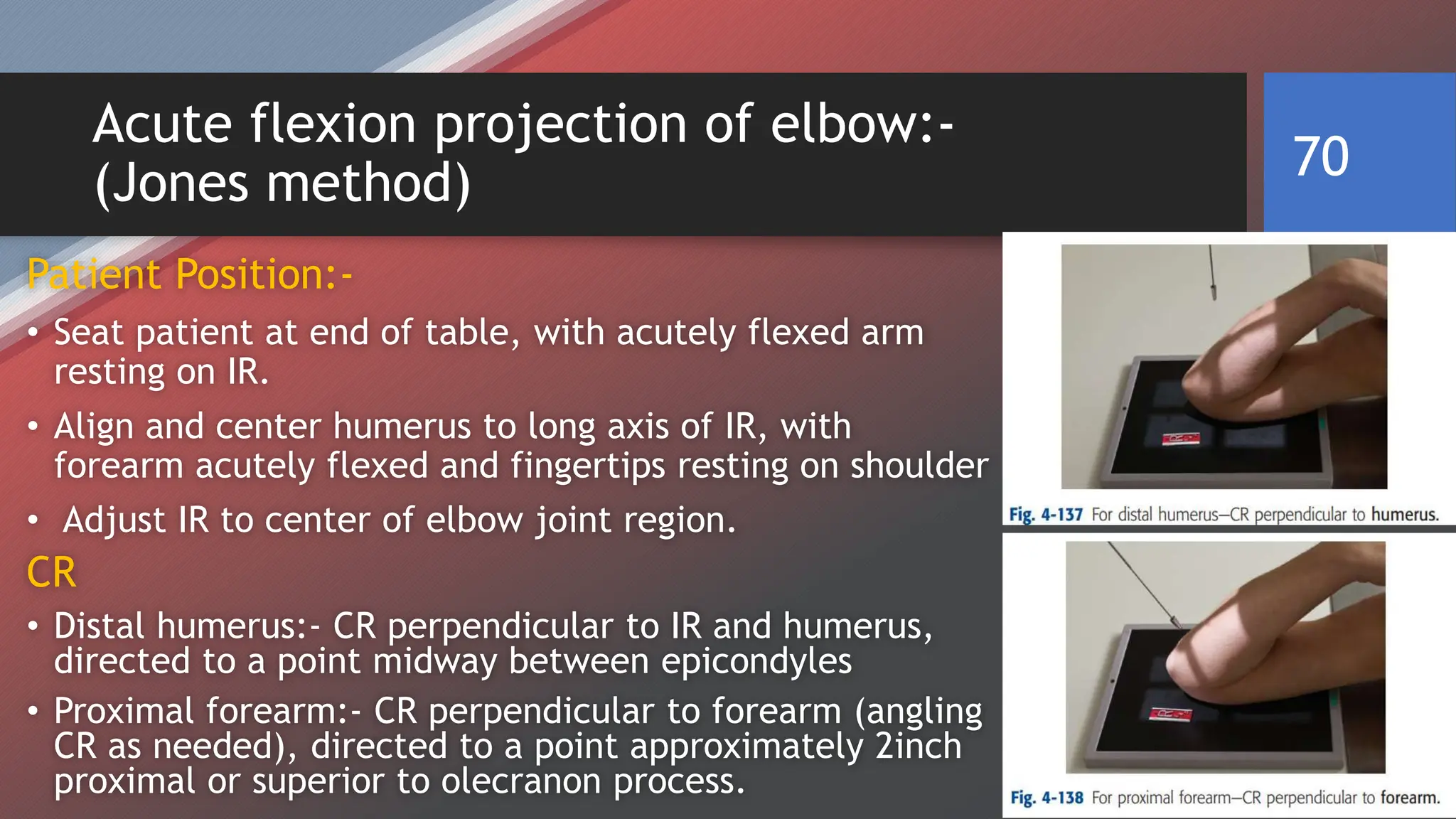 RADIOGRAPHIC TECHNIQUE OF UPPER LIMB BY SAGAR CHAULAGAIN | PPTX
