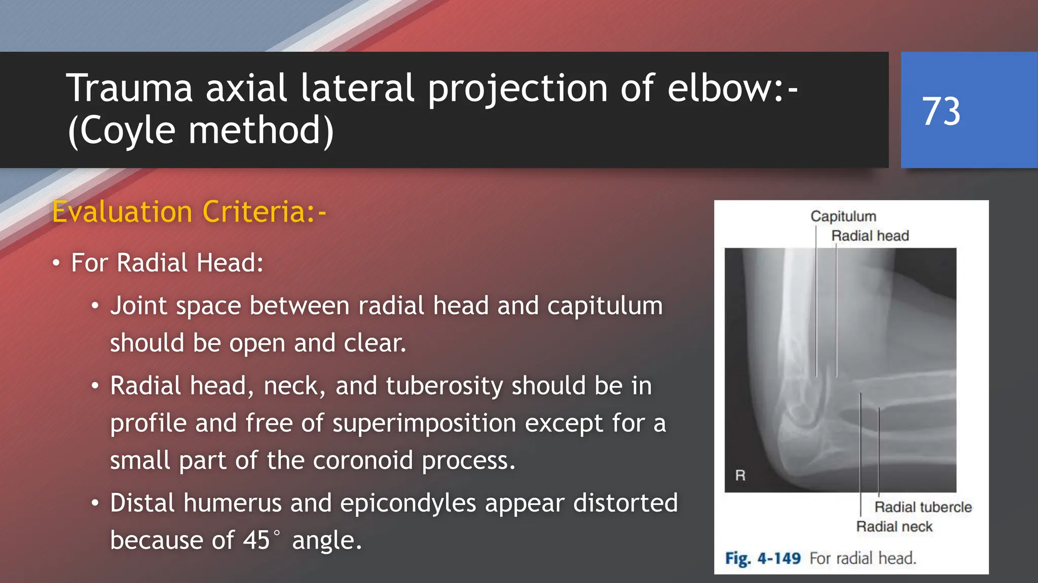 RADIOGRAPHIC TECHNIQUE OF UPPER LIMB BY SAGAR CHAULAGAIN | PPTX