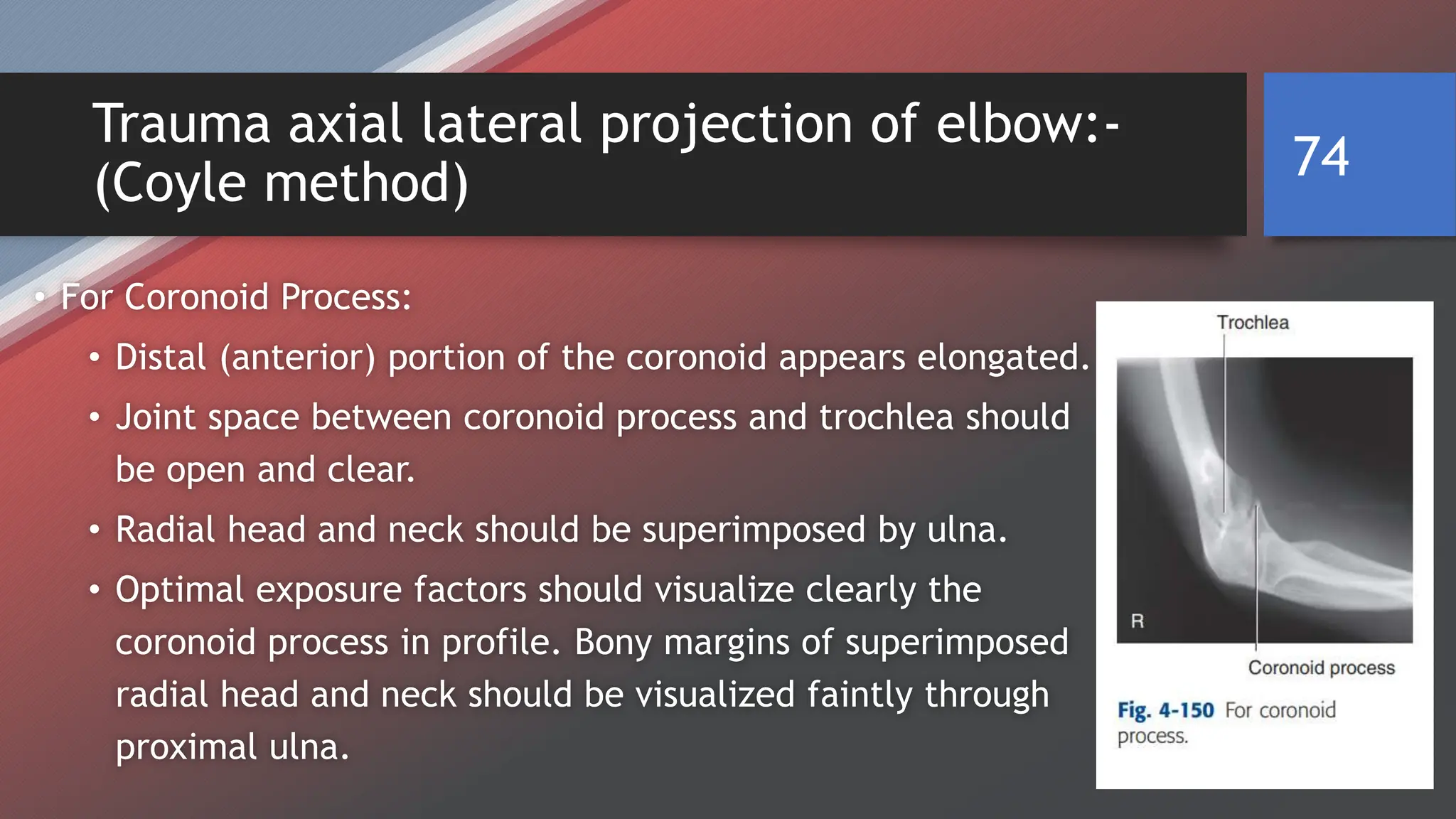 RADIOGRAPHIC TECHNIQUE OF UPPER LIMB BY SAGAR CHAULAGAIN | PPTX
