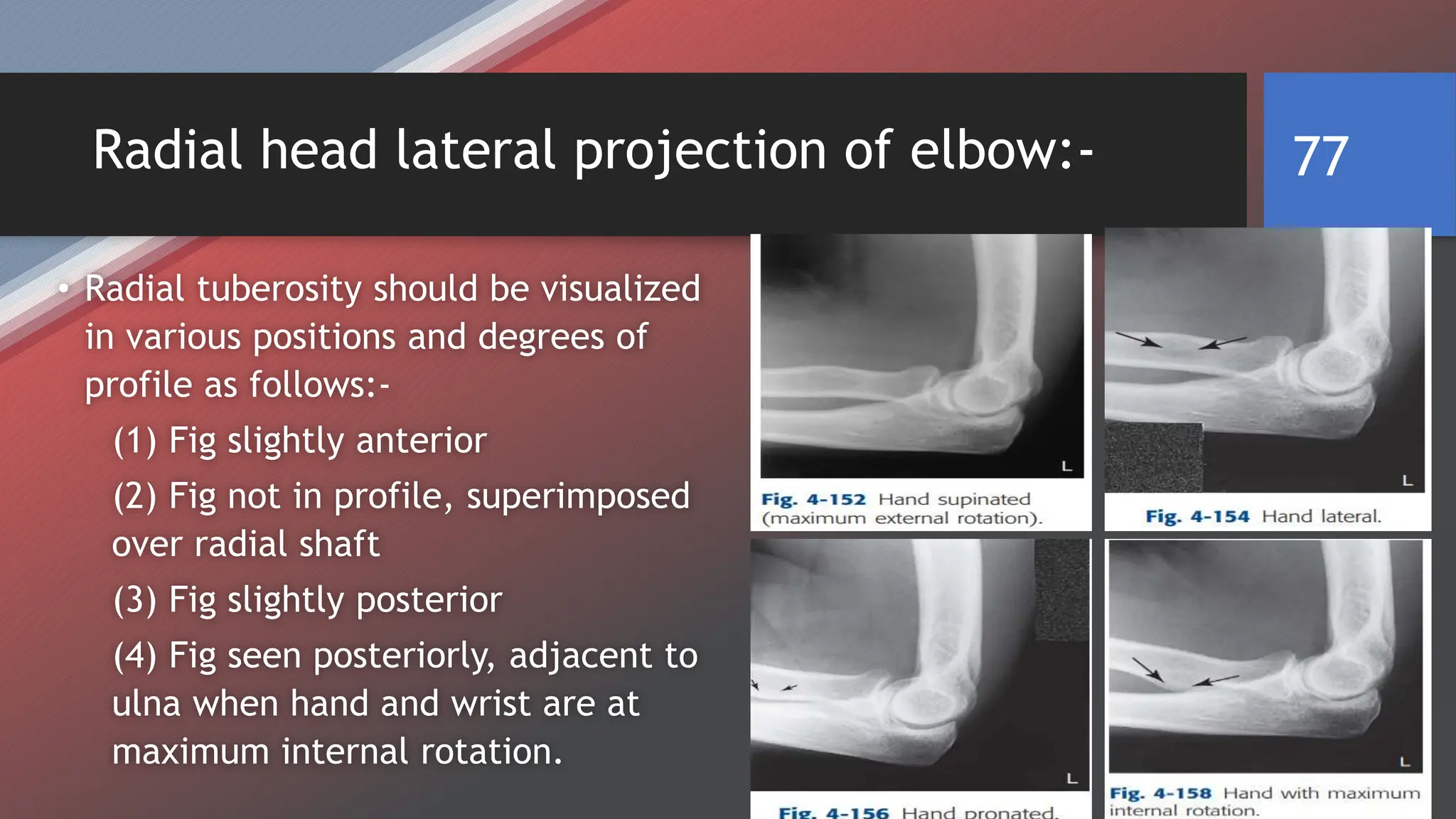 RADIOGRAPHIC TECHNIQUE OF UPPER LIMB BY SAGAR CHAULAGAIN | PPTX