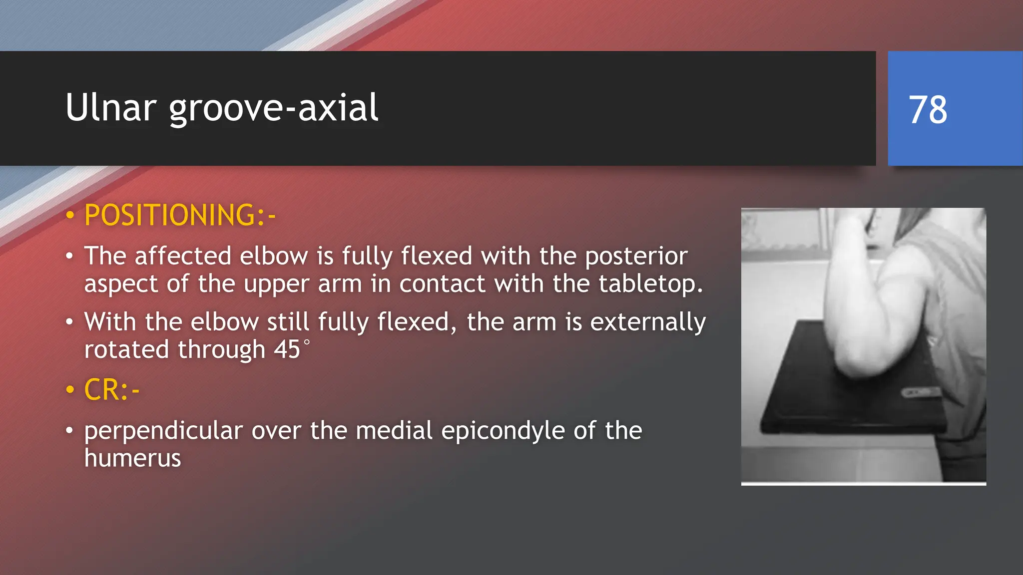 RADIOGRAPHIC TECHNIQUE OF UPPER LIMB BY SAGAR CHAULAGAIN | PPTX
