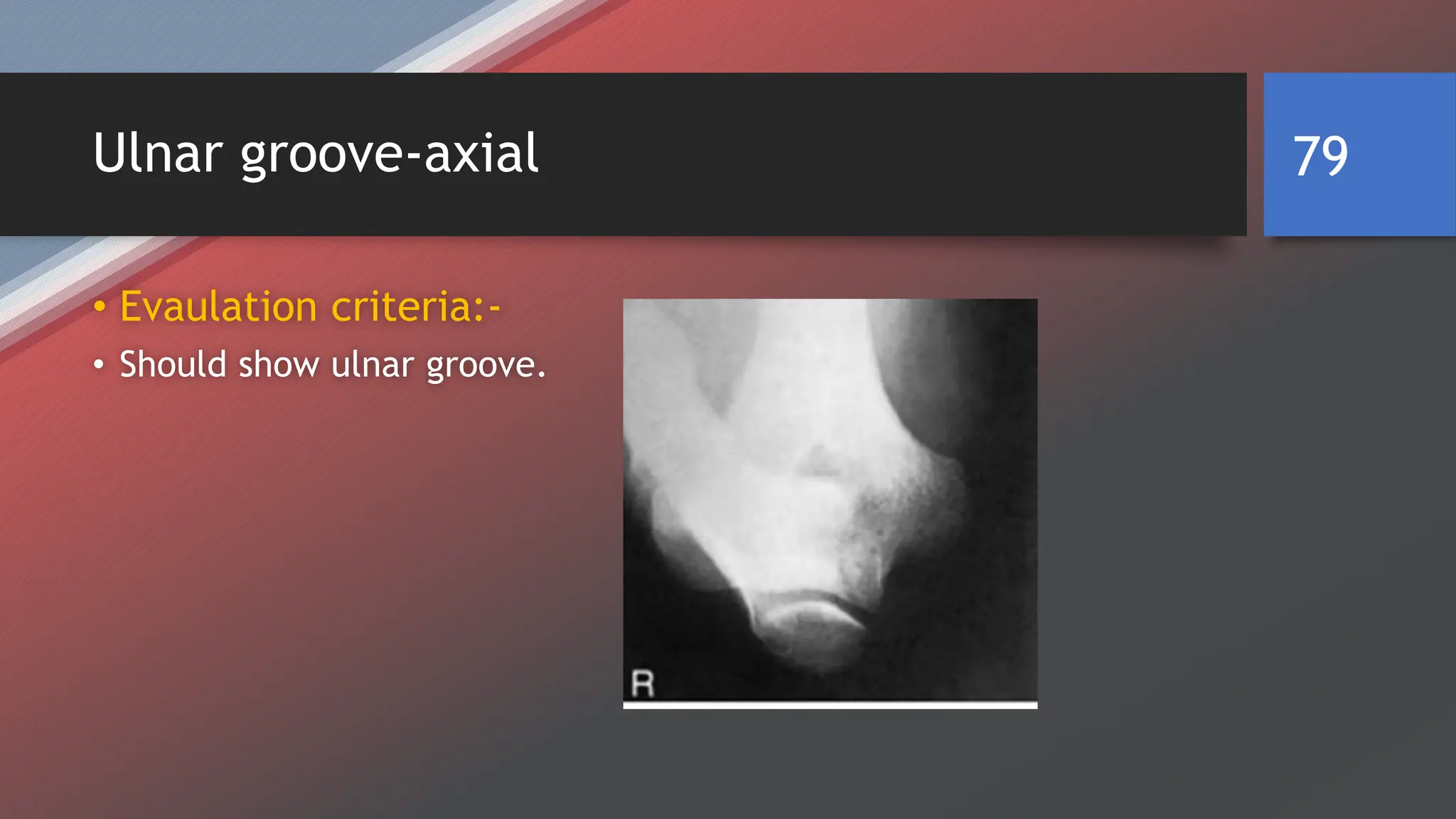 RADIOGRAPHIC TECHNIQUE OF UPPER LIMB BY SAGAR CHAULAGAIN | PPTX