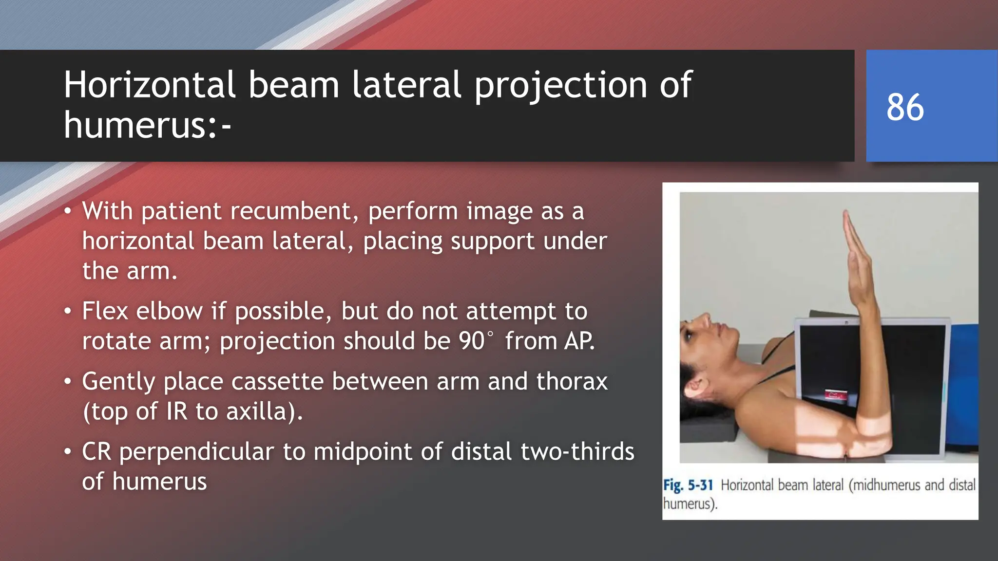 RADIOGRAPHIC TECHNIQUE OF UPPER LIMB BY SAGAR CHAULAGAIN | PPTX