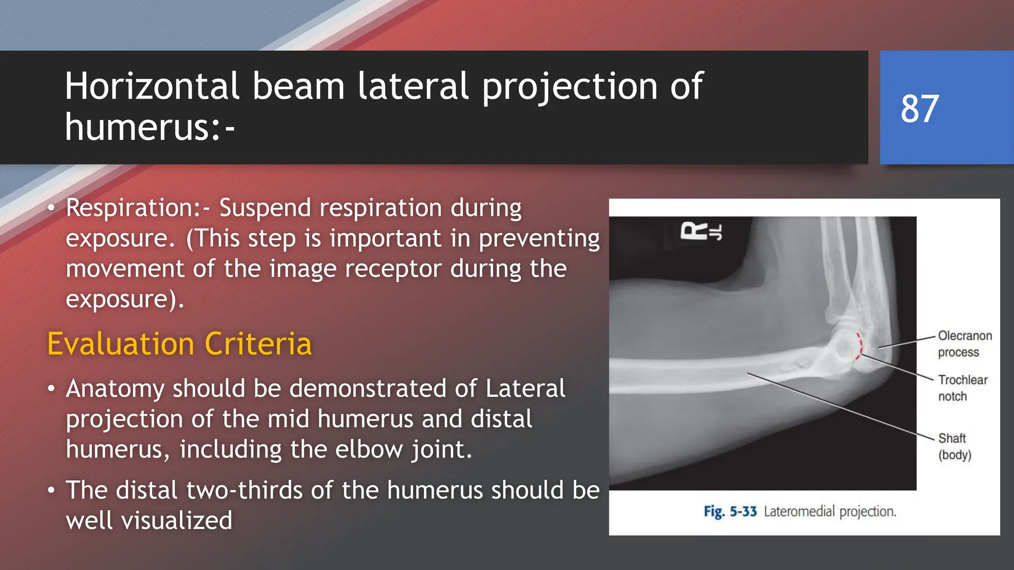 RADIOGRAPHIC TECHNIQUE OF UPPER LIMB BY SAGAR CHAULAGAIN | PPTX