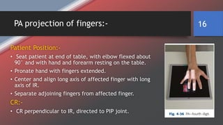RADIOGRAPHIC TECHNIQUE OF UPPER LIMB BY SAGAR CHAULAGAIN | PPTX