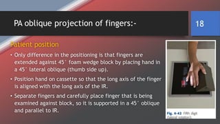 RADIOGRAPHIC TECHNIQUE OF UPPER LIMB BY SAGAR CHAULAGAIN | PPTX