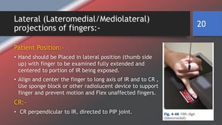 RADIOGRAPHIC TECHNIQUE OF UPPER LIMB BY SAGAR CHAULAGAIN | PPTX