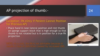 RADIOGRAPHIC TECHNIQUE OF UPPER LIMB BY SAGAR CHAULAGAIN | PPTX