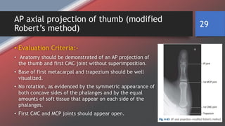 RADIOGRAPHIC TECHNIQUE OF UPPER LIMB BY SAGAR CHAULAGAIN | PPTX