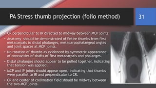 RADIOGRAPHIC TECHNIQUE OF UPPER LIMB BY SAGAR CHAULAGAIN | PPTX