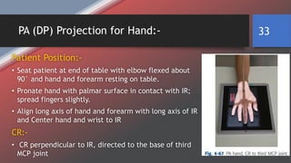 RADIOGRAPHIC TECHNIQUE OF UPPER LIMB BY SAGAR CHAULAGAIN | PPTX