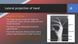 RADIOGRAPHIC TECHNIQUE OF UPPER LIMB BY SAGAR CHAULAGAIN | PPTX