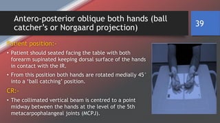 RADIOGRAPHIC TECHNIQUE OF UPPER LIMB BY SAGAR CHAULAGAIN | PPTX