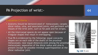 RADIOGRAPHIC TECHNIQUE OF UPPER LIMB BY SAGAR CHAULAGAIN | PPTX