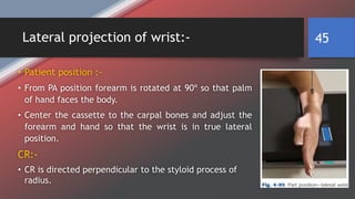 RADIOGRAPHIC TECHNIQUE OF UPPER LIMB BY SAGAR CHAULAGAIN | PPTX
